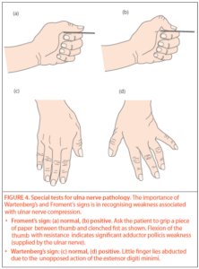 Ulnar Nerve - Anatomy, Course, Structure, Function