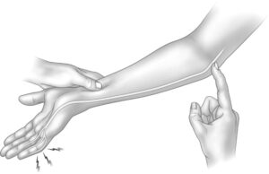 Special test for the neurological dysfunction of the elbow joint: